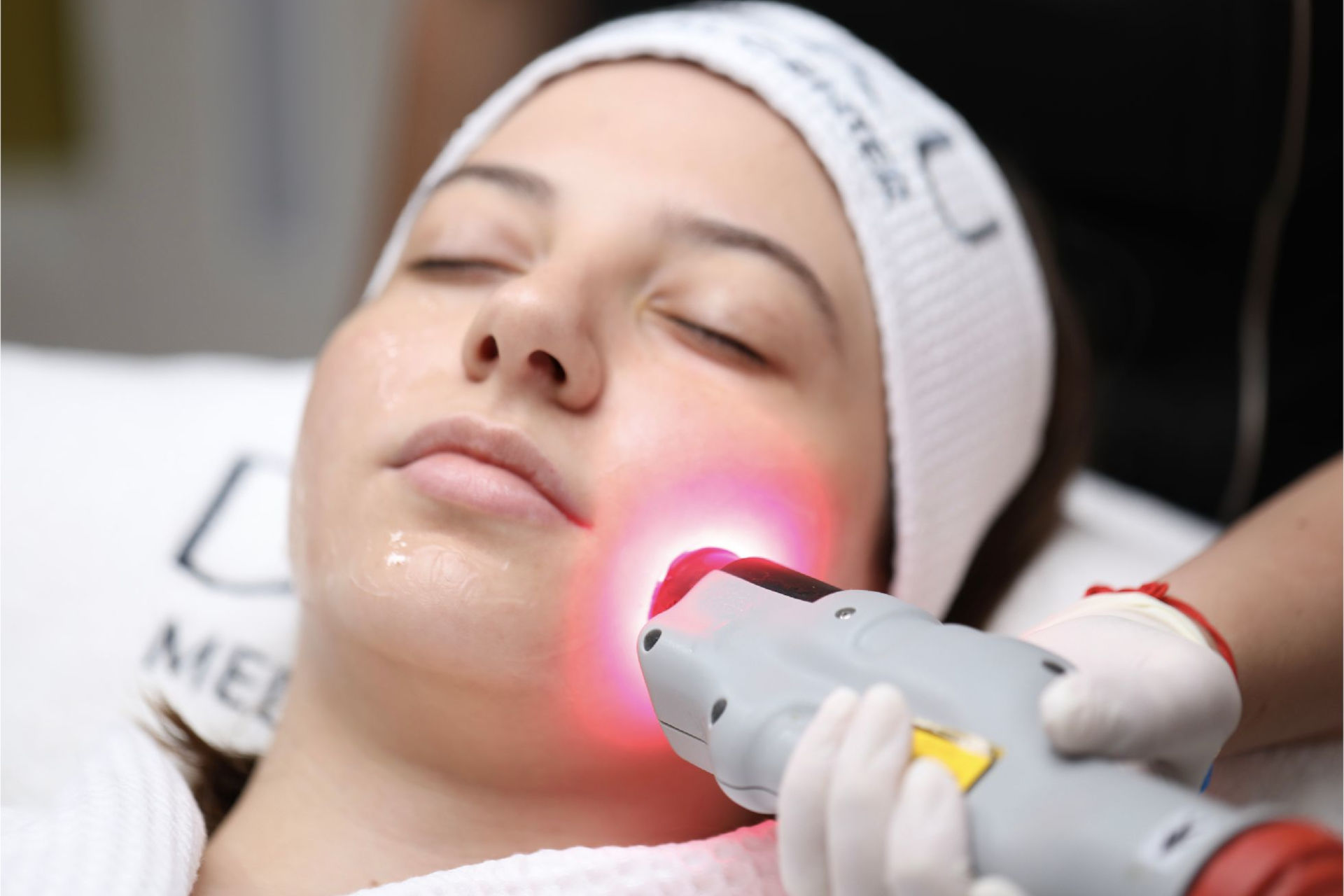 Como é o antes e depois do Red touch? – Dermatologista especializada em ...